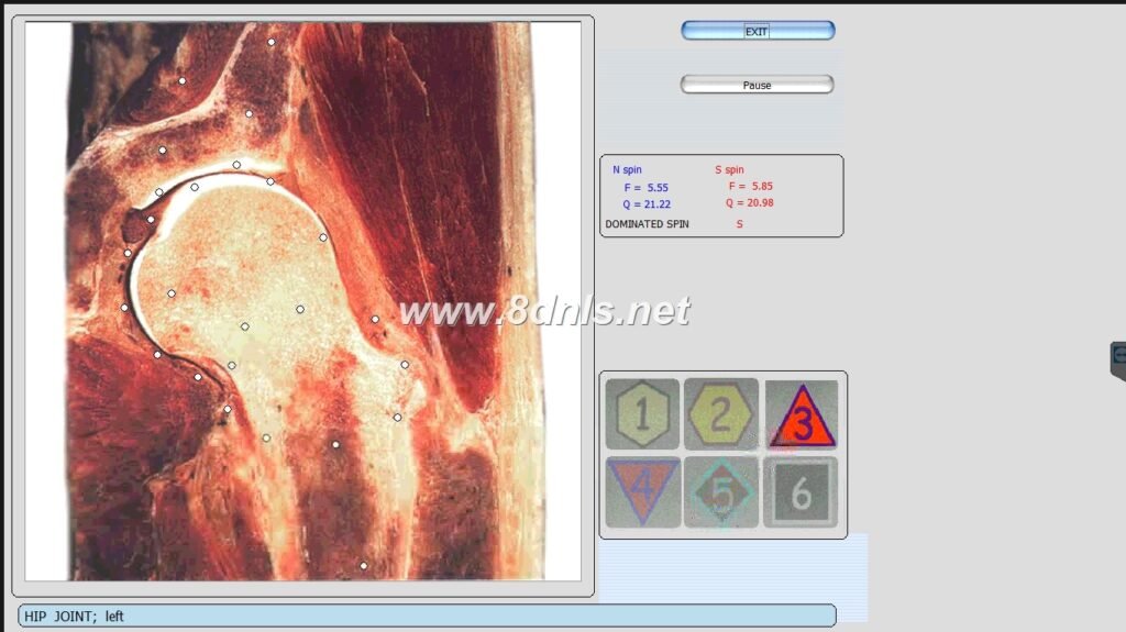 Hunter Metatron Device: Expert Guide To Advanced Bioresonance ...